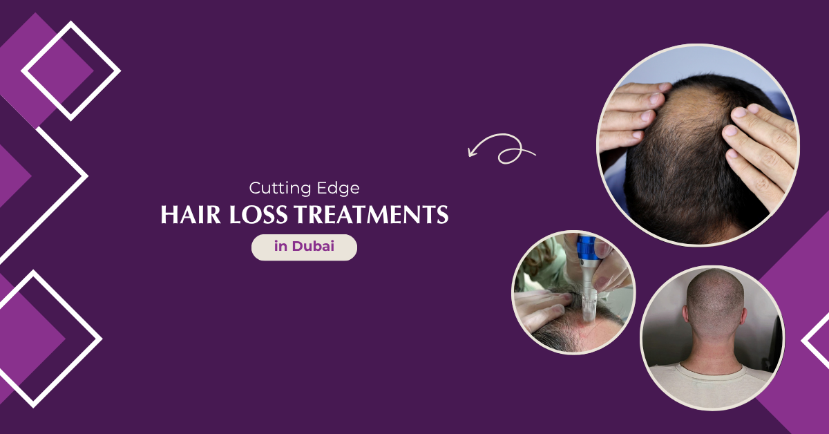 Cutting-Edge Hair Loss Treatments in Dubai